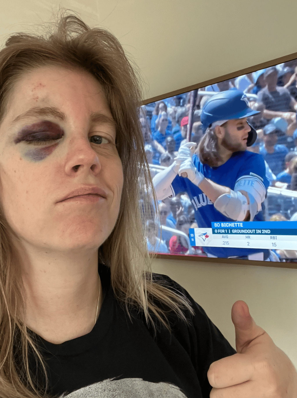 Une spectatrice reçoit une balle de baseball à près de 200 km/h en ...