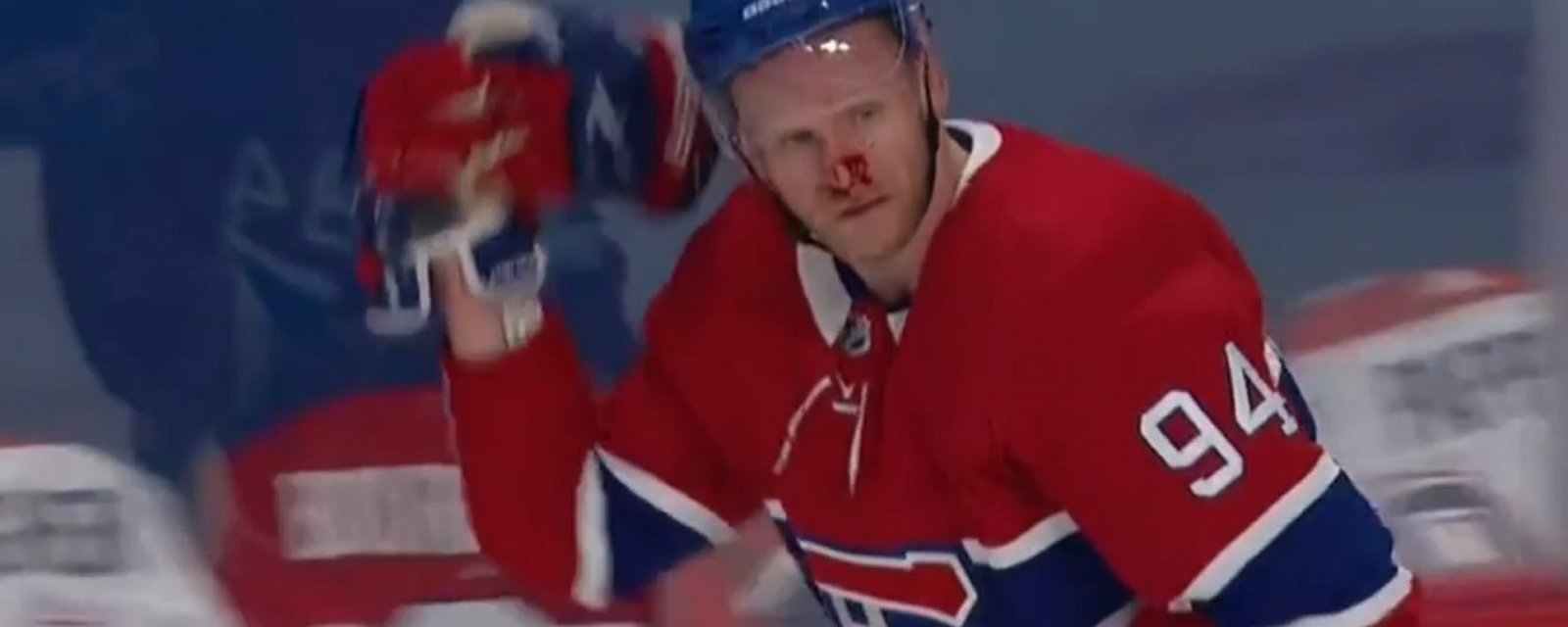 Rewind: Four officials miss a blatant, and bloody, high stick on Corey ...