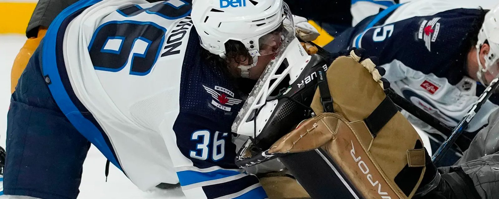 Morgan Barron looks “like he got attacked by a shark” following Game 1 ...