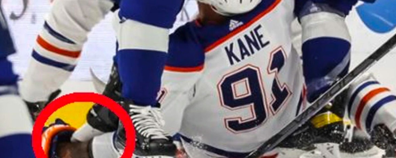 Mandatory equipment changes after a rash of dangerous skate lacerations ...