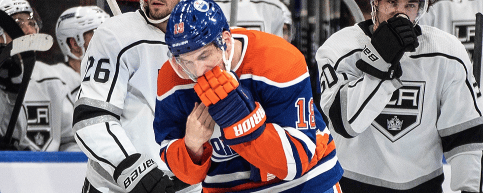 Zach Hyman describes goal scored off his face - HockeyFeed