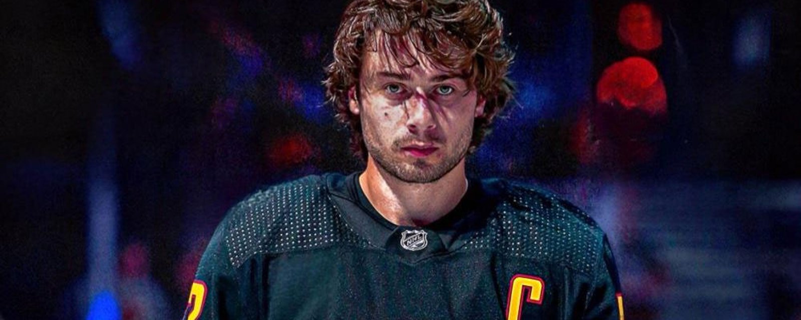 Canucks get some brutal injury news on captain Quinn Hughes - HockeyFeed