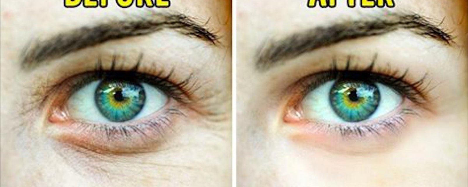 Réduisez naturellement vos rides avec ces 7 solutions très simples - Trucs et Bricolages