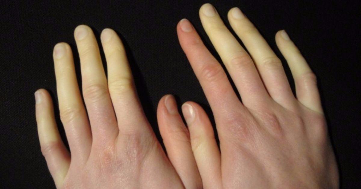 Ces symptômes sont inquiétants et devraient nous alerter, pourtant on ...