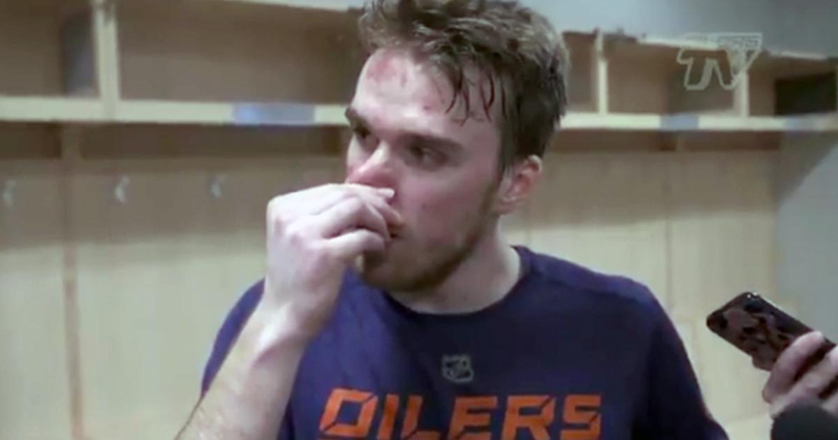 A frustrated McDavid calls out management and coaching for another ...