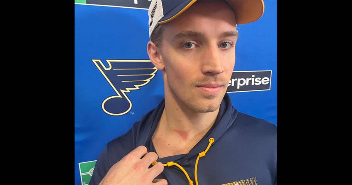 Dylan Holloway returns and explains to fans and media exactly what ...