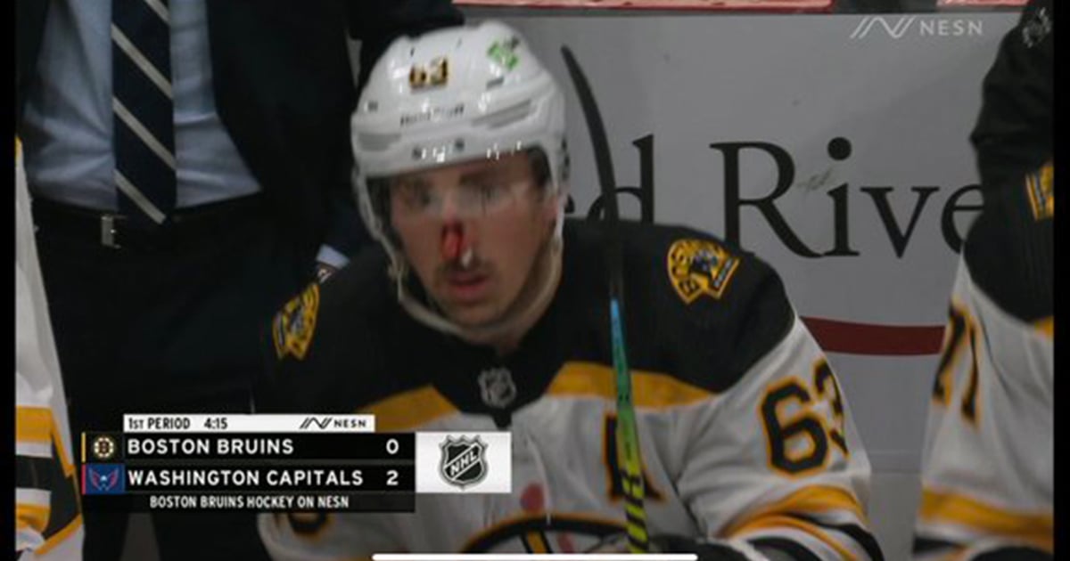 Marchand takes a high stick to the face, gets busted wide open - HockeyFeed